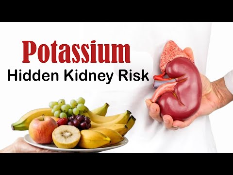 Is Potassium Giving You Kidney Disease? Understand for Better Kidney Health