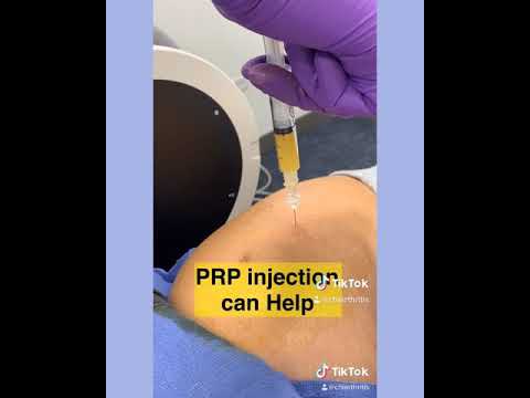 Hip Pain treatment- PRP - Chicago Arthritis and Regenerative Medicine