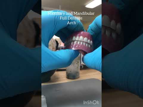 Maxillary and Mandibular Full Denture Arch