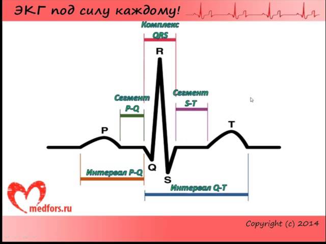 Understanding ECG: Waves, Segments, and Intervals Explained | Galaxy.ai