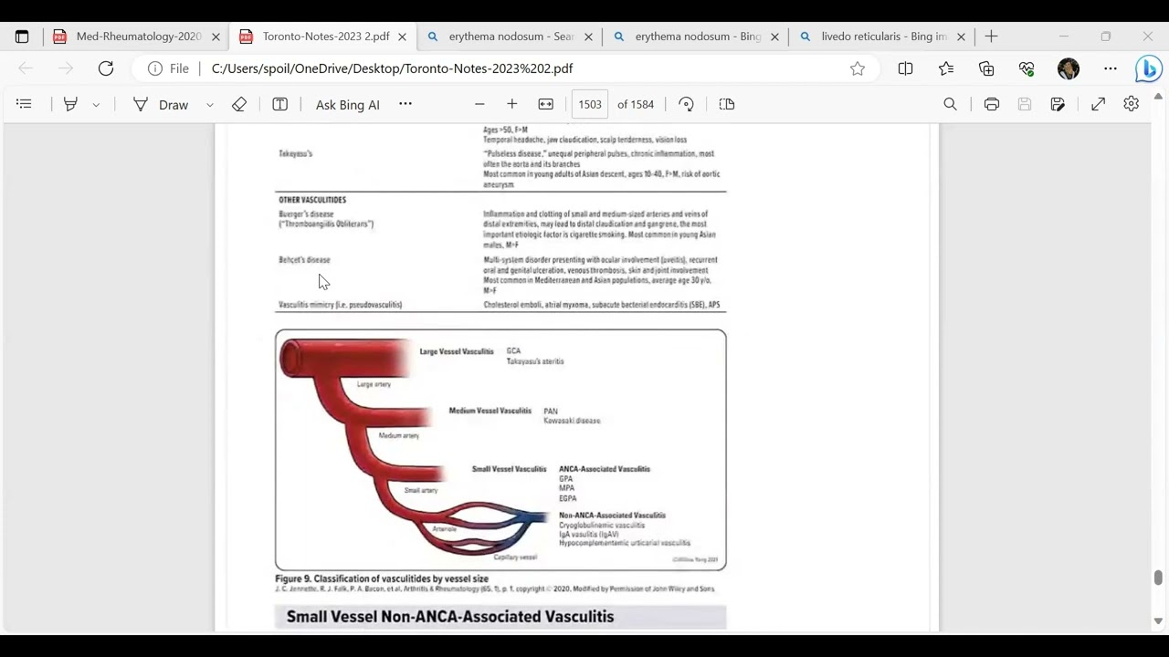 rheumatology part 3 toronto notes