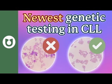 Emerging CLL Diagnostic Tests! #CLL