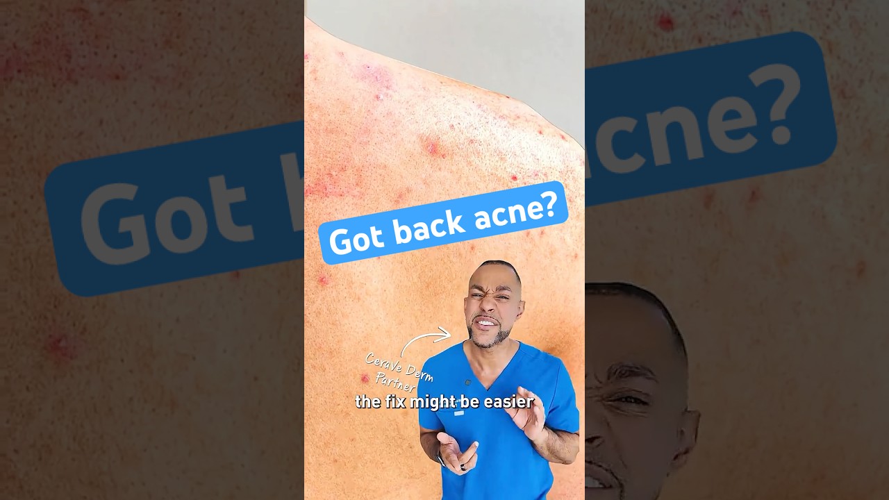 How to get rid of back acne