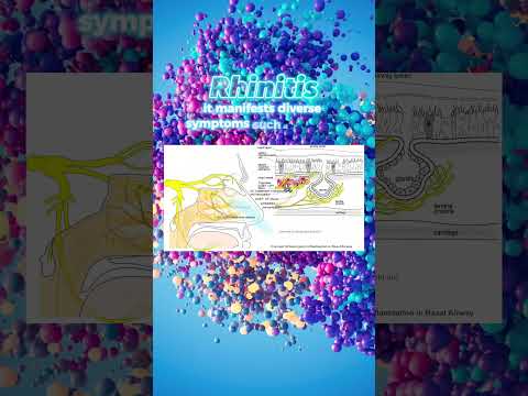 RHINITIS | MEDICAL DEFINITION VOCABULARY TERMINOLOGY