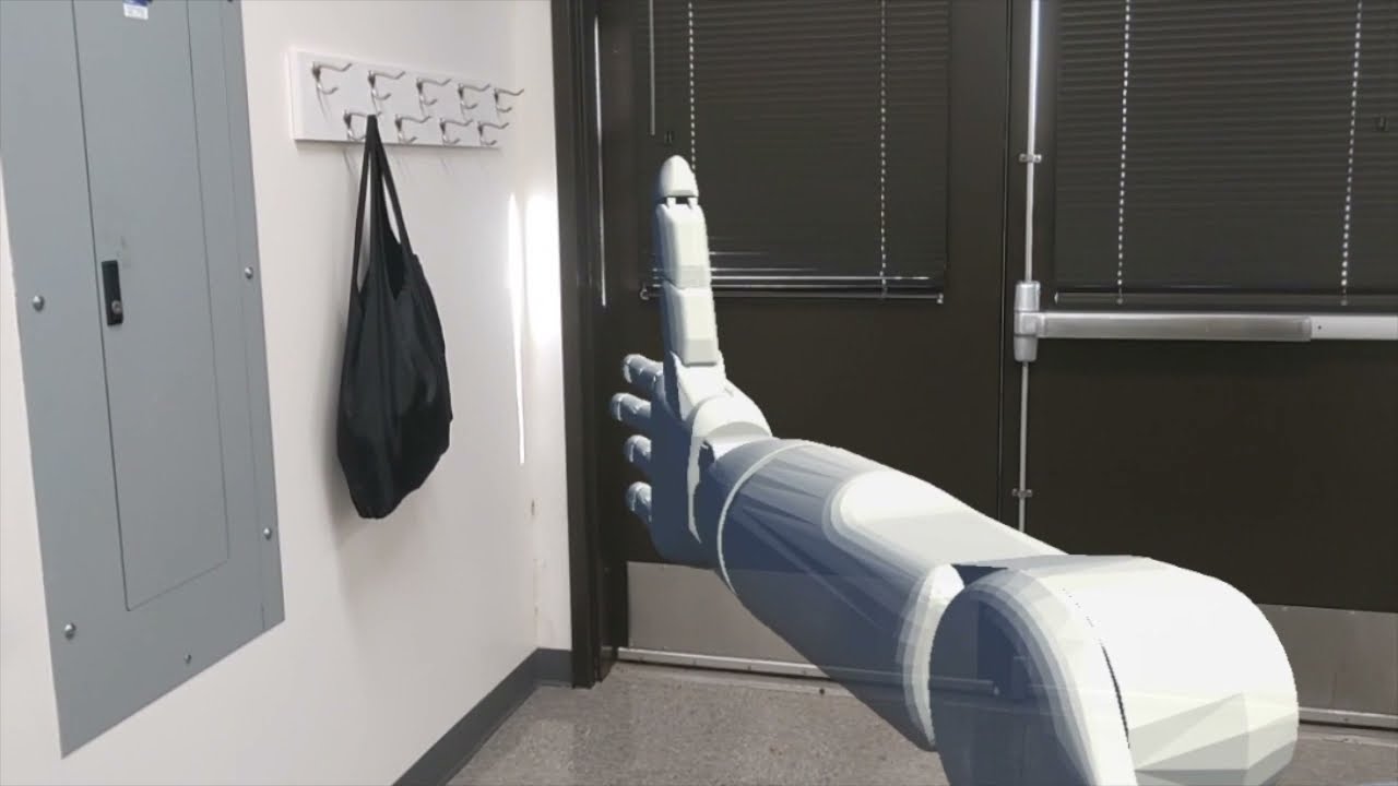Intelligent Prosthetic Arm Project (Stanford ARMLab)
