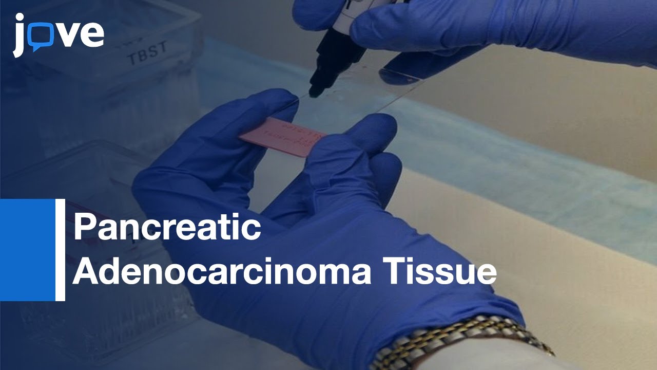 Immunohistochemical Staining: B7-H1 (PD-L1) On Paraffin-Embedded Slides l Protocol Preview