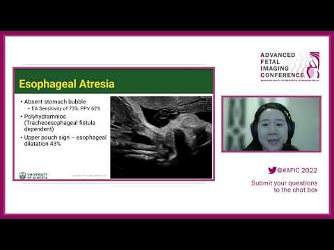 Fetal Abdomen and Anterior Abdominal Wall | Dr. Sheryl Choo | Advanced fetal Imaging Conference