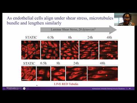 BINA Scientific Speaker Series | Feb 11 2025 | Katiannah Moise