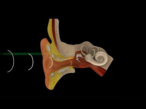 Speech to Laser to Sound