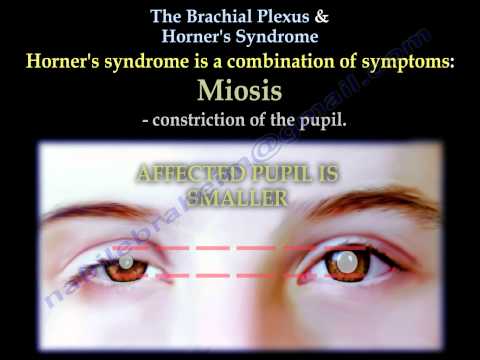 The Brachial Plexus & Horner's Syndrome - Everything You Need To Know - Dr. Nabil Ebraheim