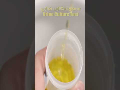 சிறுநீர் தொற்று மற்றும் குறைப்பிரசவம் Asymptomatic bacteriuria