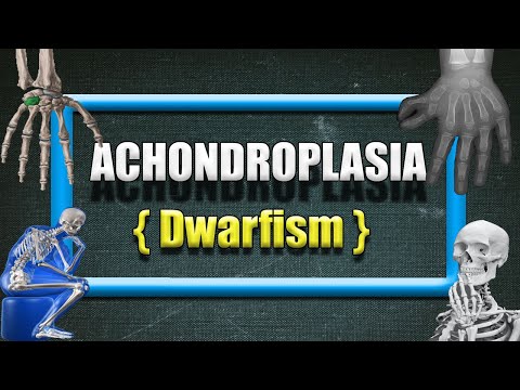 Achondroplasia | Dwarfism | बौनापन | Autosomal Genetic Disorders | Dominant Genetic Mutation