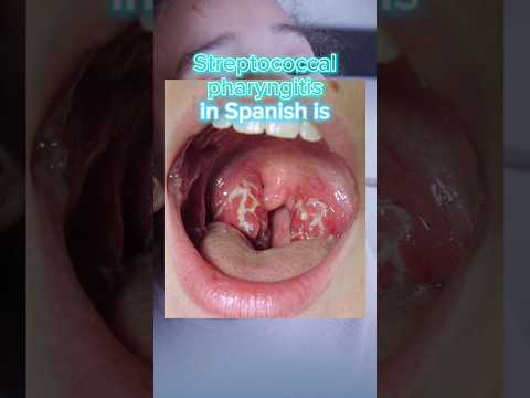 STREPTOCOCCAL PHARYNGITIS IN SPANISH | Medical Consecutive Interpreting