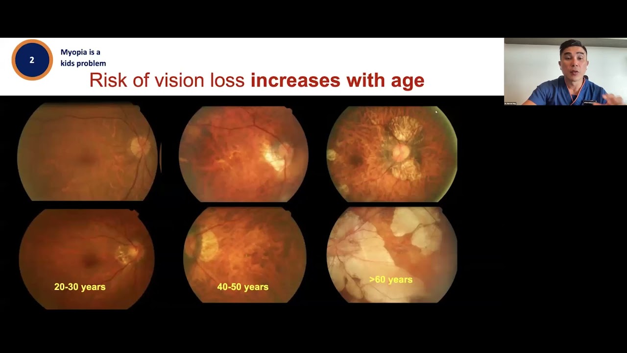 Lecture: Myopia: Dispelling Myths and Misconceptions