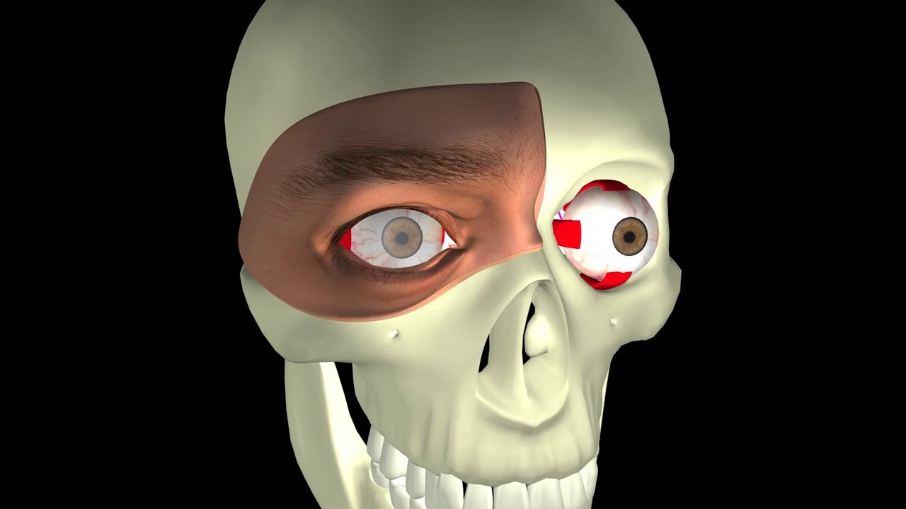 TED (Thyroid Eye Disease) - 