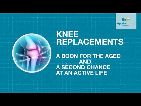Knee Replacement Surgery at Apollo Adlux Hospital