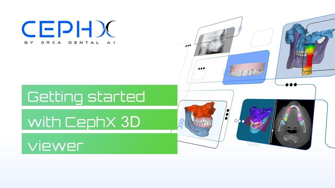 Getting started with CephX 3D viewer (Old version for new version - https://youtu.be/KvUIy7Yl-9Q)