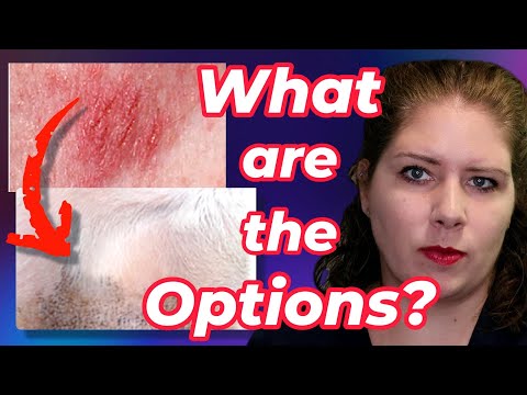 Treatments for Allergies | Vet's Voice (Atopic Dermatitis Part 2)