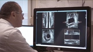 bk5000 Ultrasound Machine | BK Medical