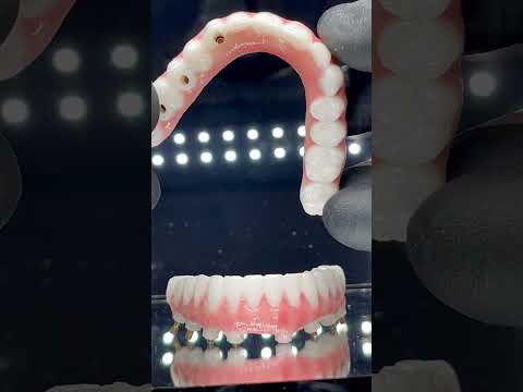 Zirconia prosthesis: the ultimate solution for missing teeth
