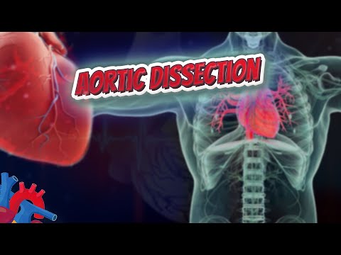 Aortic dissection (Human Heart ❤️ & Cardiology) ❤️🔊✅