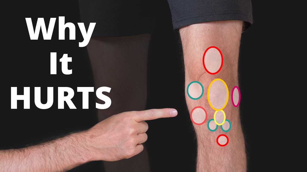 Why Your Knee Hurts: Knee Pain Types by Location (Chart + Symptoms)