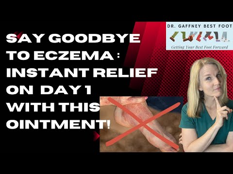This ointment made my eczema disappear!