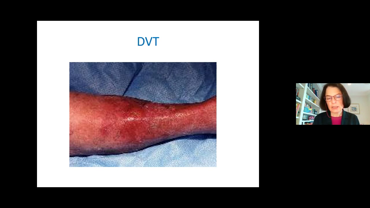 Webinar - APS Antiphospholipid Syndrome with Dr  Niamh O’Connellinfo