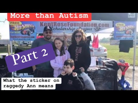 More than Autism life with Darin part 2! chromosome ring 22 deletion 13.3 and celiac disease