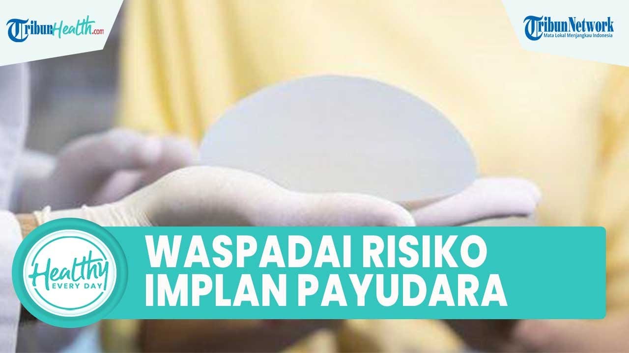 Catat! Risiko Pakai Implan Payudara yang Perlu Diwaspadai, Begini ...