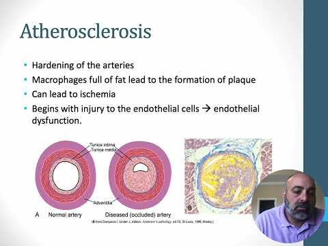11) Cardiovascular Diseases lecture video