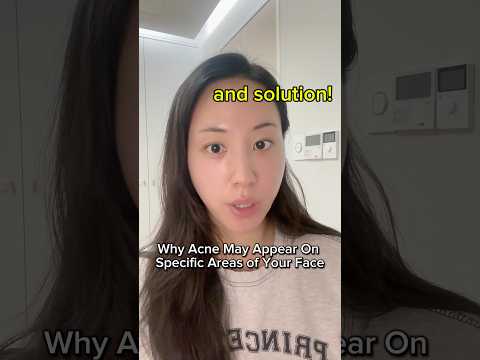 Reasons for Acne in Specific Areas