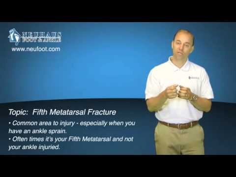 What is a Fifth Metatarsal Fracture?