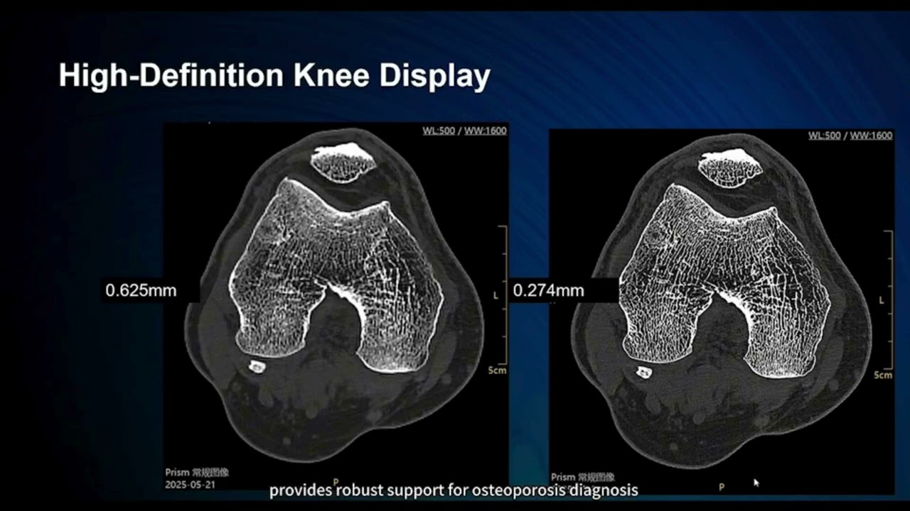 Product Discovery Tour by Neusoft