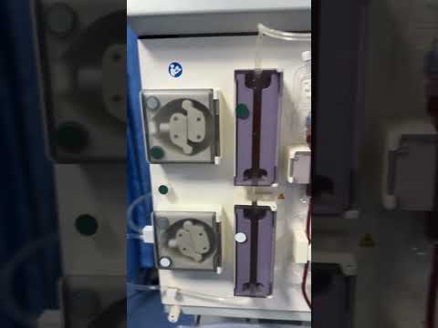 Plasmapheresis in Multi-filtrate Fresenius machine ,This video is made in purpose to help you