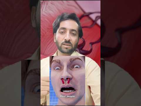Epistaxis (nose bleeding) management (pashtu) ناک سے خون نکلنے کے صورت میں کیا کریں ۔ د پوزی نہ وینہ