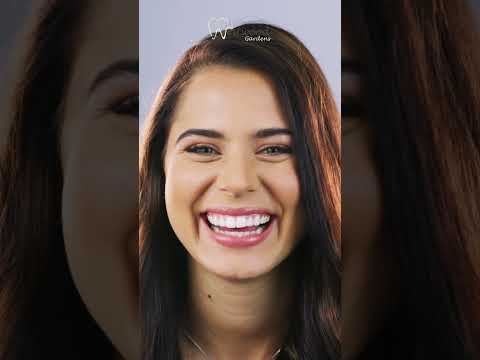 Would you like a new smile? ✨