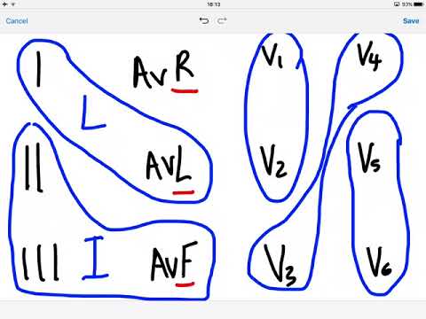 ECG Interpretation | ECG Made Easy | Coronary Artery | Location of MI | STEMI | NSTEMI