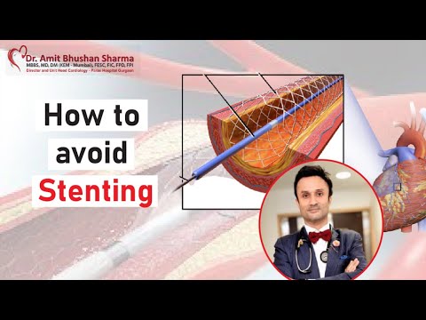 Heart Stents - How to Avoid Stenting - Dr. Amit Bhushan Sharma | Cardiologist #stent #healthyheart
