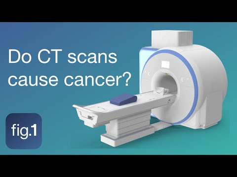 Do CT scans (computed tomography scans) cause cancer?
