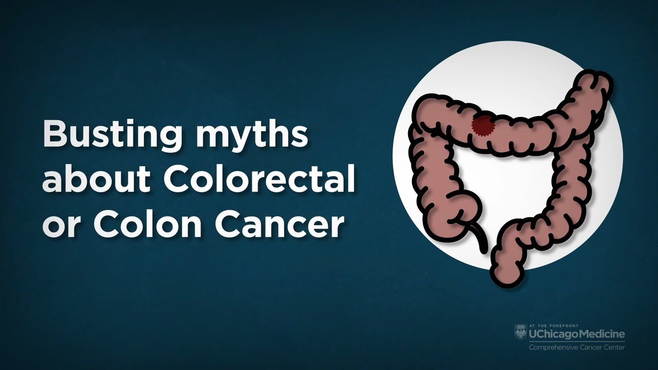Myth vs. Fact: Colon Cancer