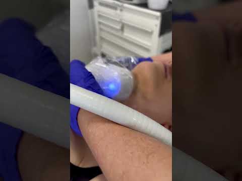What is Cryo T-shock?