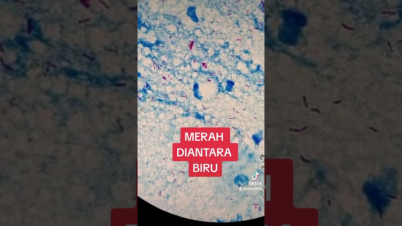 PEMERIKSAAN BTA UNTUK MEMBANTU DIAGNOSA TB PARU #laboratory #kesehatan #shorts #bta #tuberkulosis