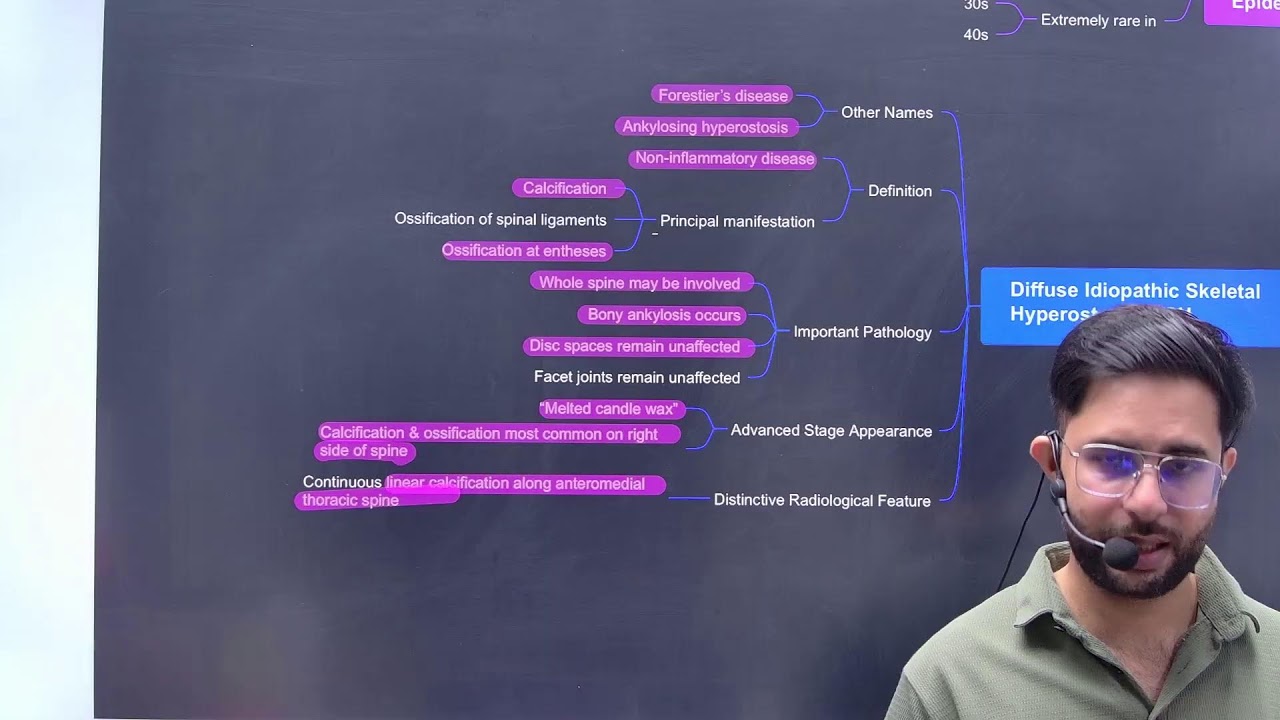 Ankylosing Spondylitis  Mind Map Orthopedics — PYT Priority Program