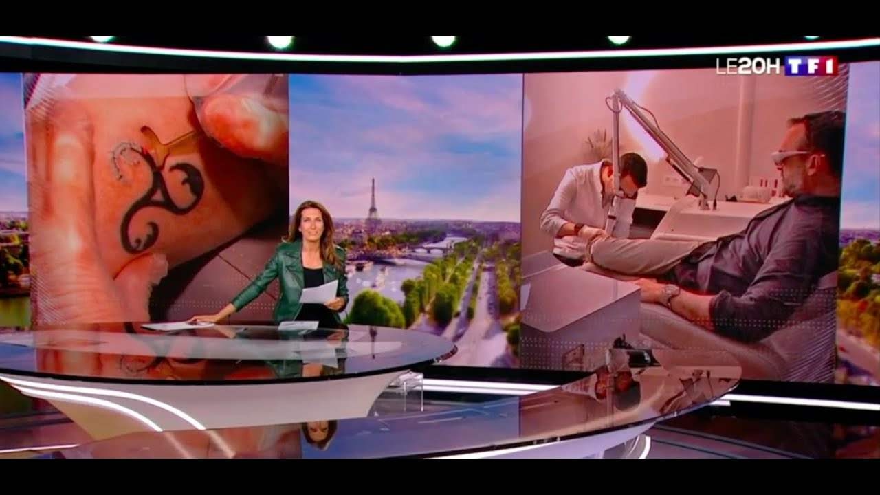 Ray studios - Centre de Détatouage | RDV en ligne