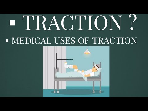 What is Traction ? Medical Uses of traction .