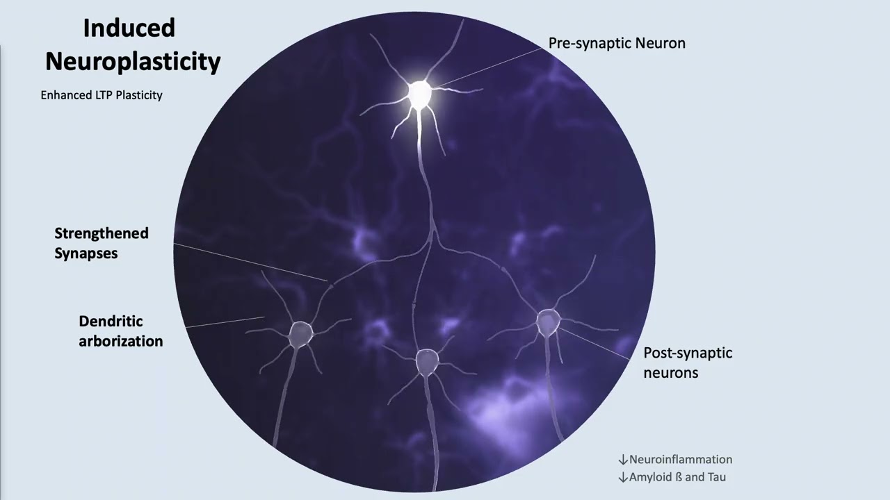 Nexstim - Aivostimulaatiolla maailmanvalloitukseen - Sivu 129 ...