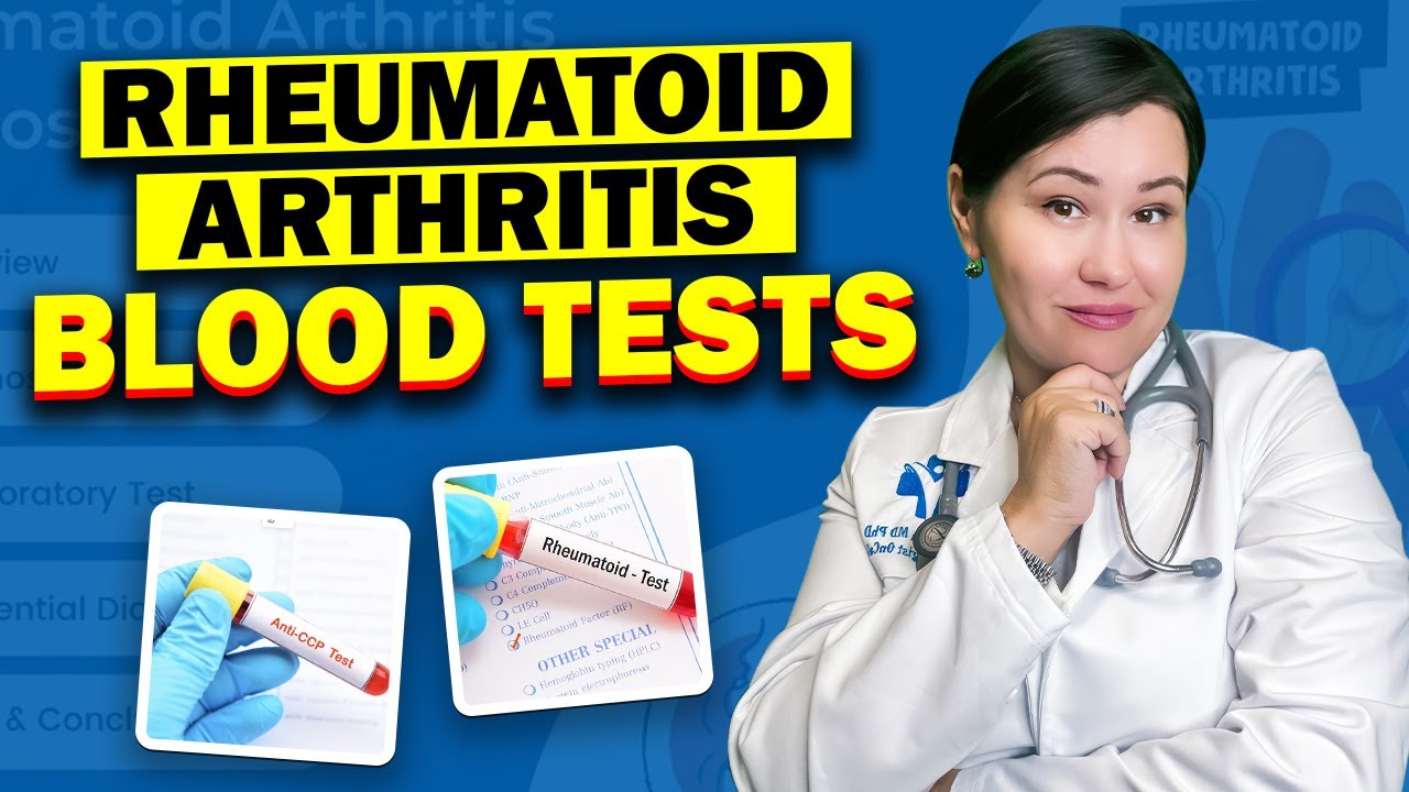 Top 5 Rheumatoid Arthritis Blood Tests That You Need To Know