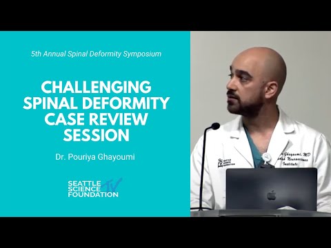 Challenging Case Review Session - Moderated by Robert A. Hart, MD