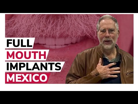 🇲🇽🤨😨 WHAT IS IT LIKE TO GET ALL ON 4 DENTAL IMPLANTS IN MEXICO? [XDentistry Tijuana Reviews]